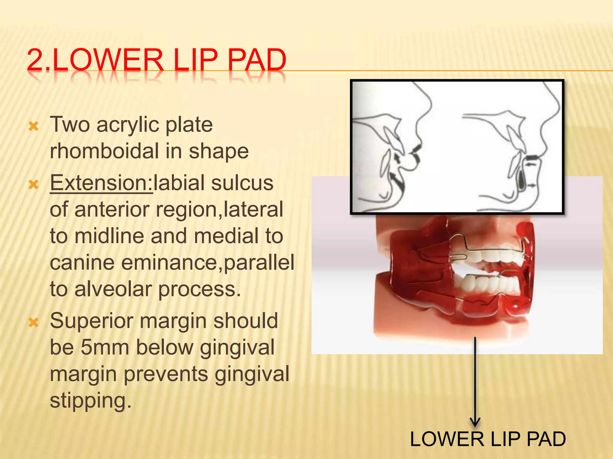 Frankel’s appliance | PPTX