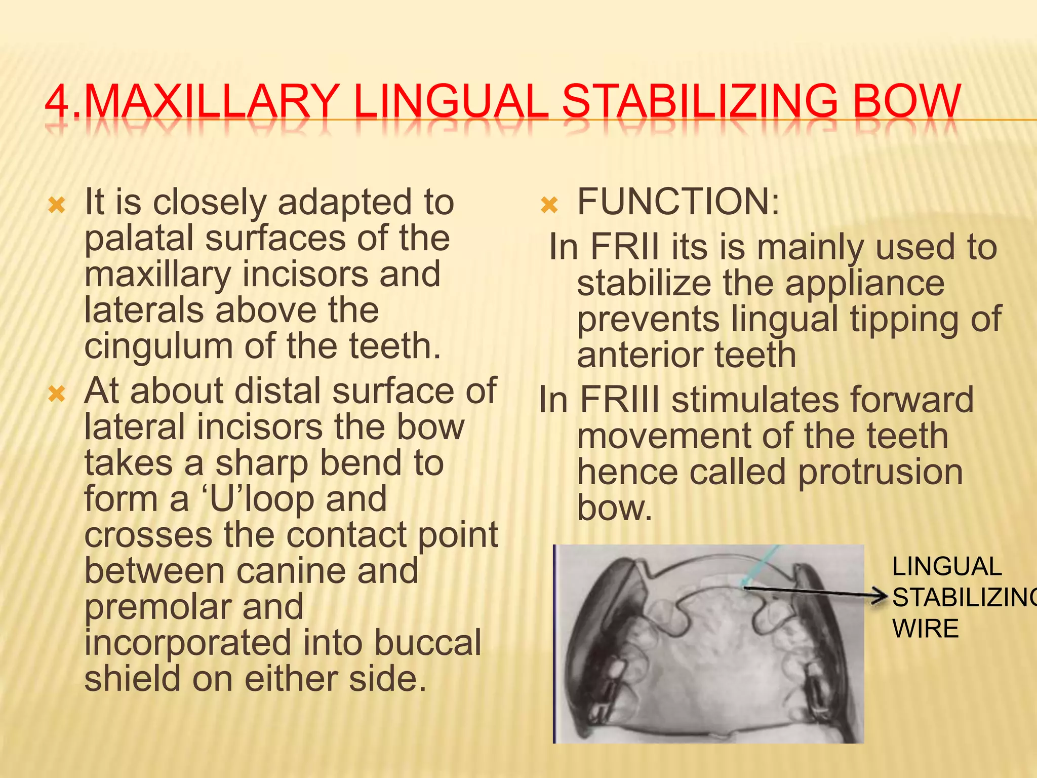 Frankel’s appliance | PPTX