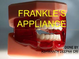 Frankel’s appliance | PPTX