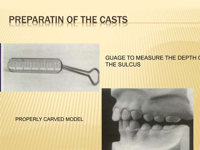 Frankel’s appliance | PPTX | Ear, Nose and Throat Conditions | Diseases ...