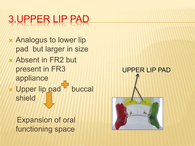 Frankel’s appliance