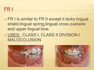 Frankel’s appliance | PPT