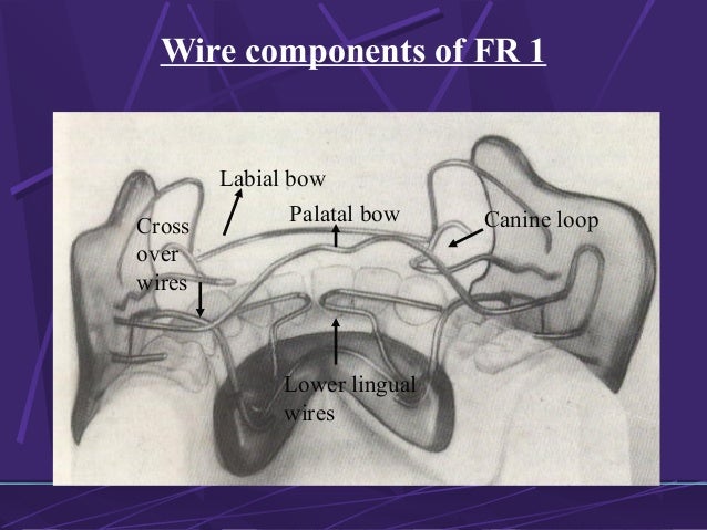 Frankel’s functional regulator