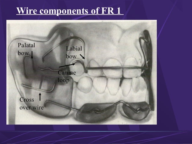 Frankel’s functional regulator
