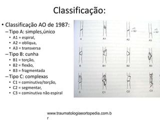 Fratura de diafise de femur | PPTX