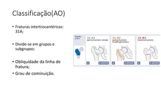 Fratura peritrocanterica | PPTX