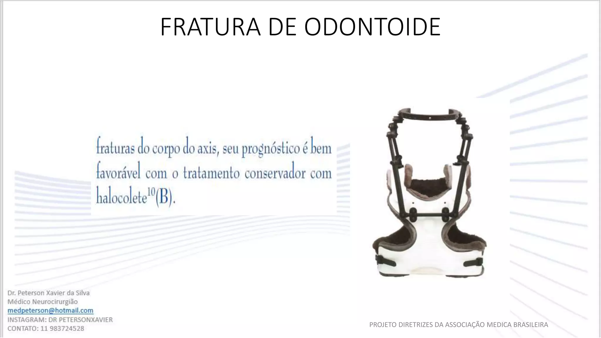 Fraturas de C2 (Odontoide) | PPTX