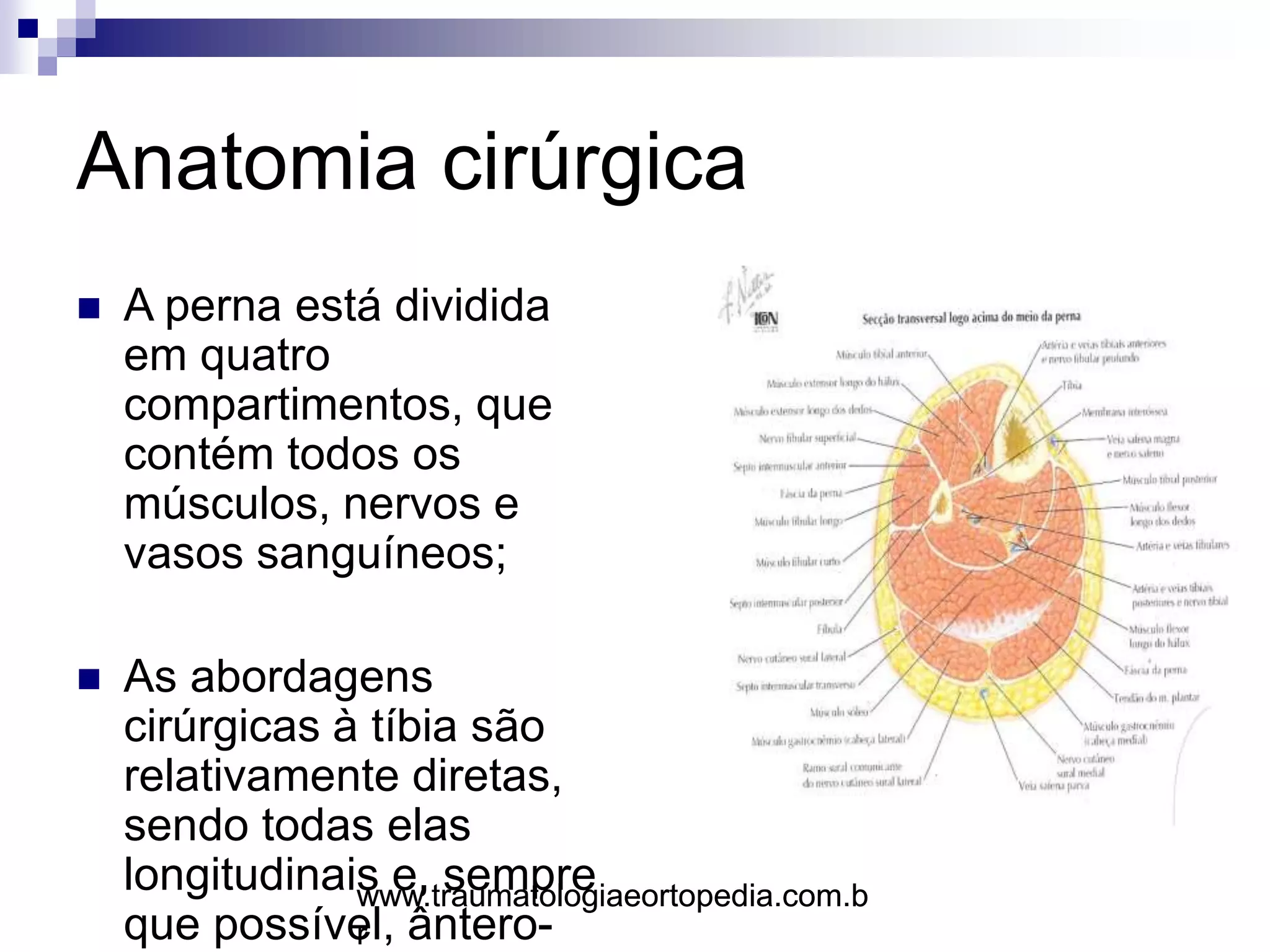 Fraturas diafisarias dos ossos da perna | PPT
