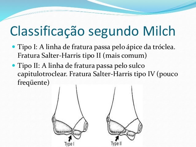 Fraturas supracondilianas Dr Omar Mohamad M. Abdallah