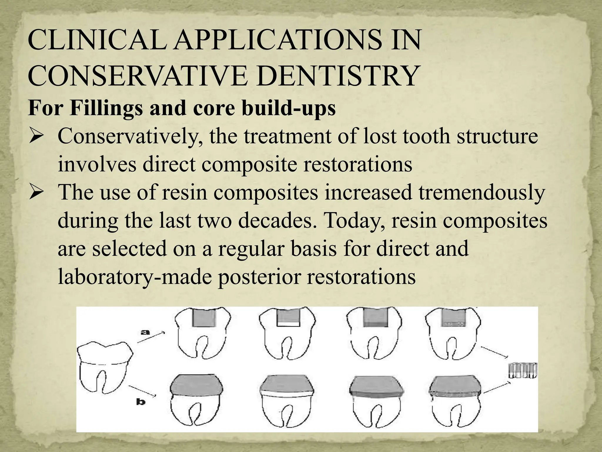 FIBRE REINFORCED COMPOSITE USEC IN CONSERVATIVE DENTISTRY AND ...
