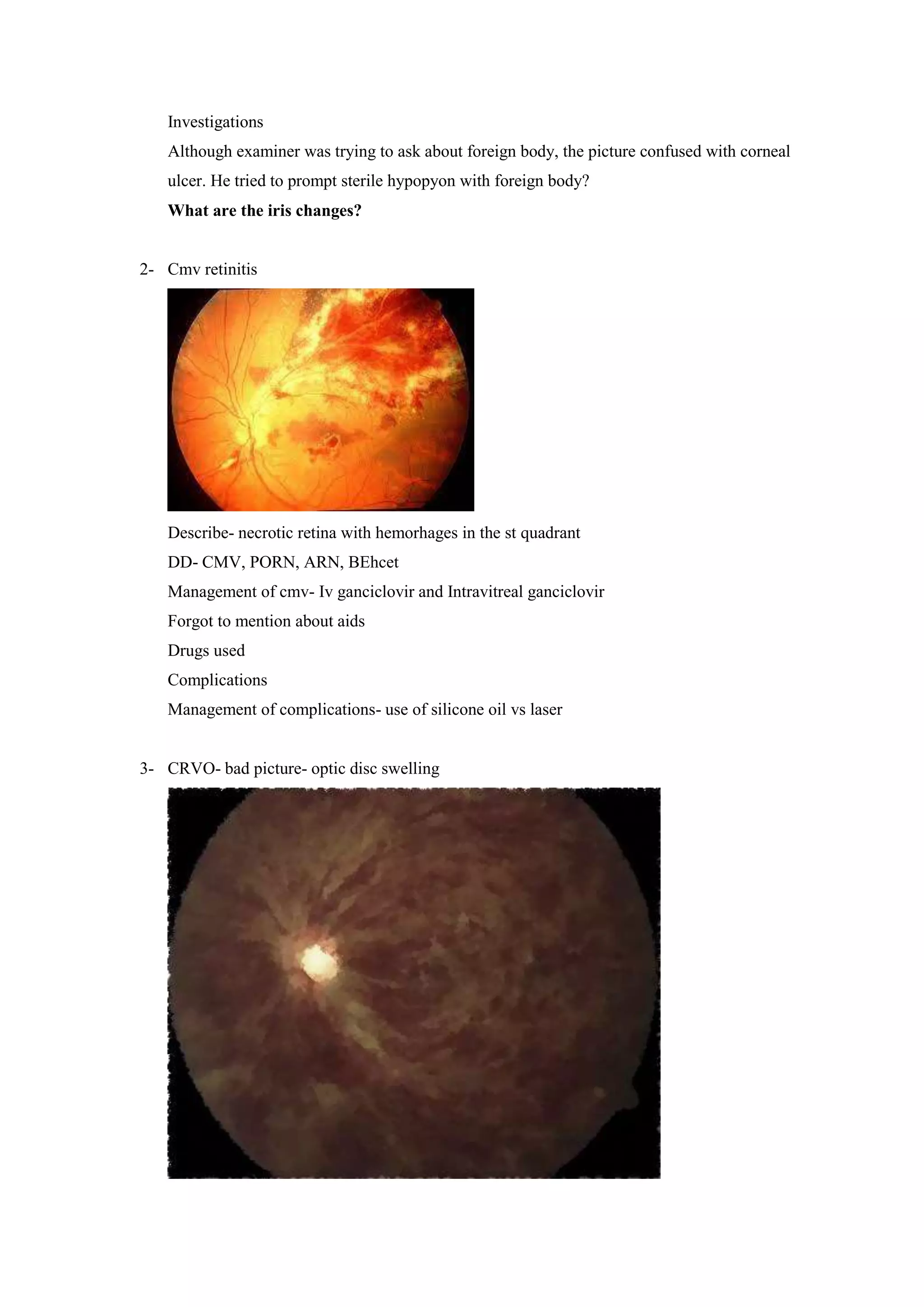 FRCS Ophthalmology.docx