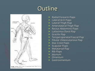 Free flaps slides for plastic surgeonss | PPT