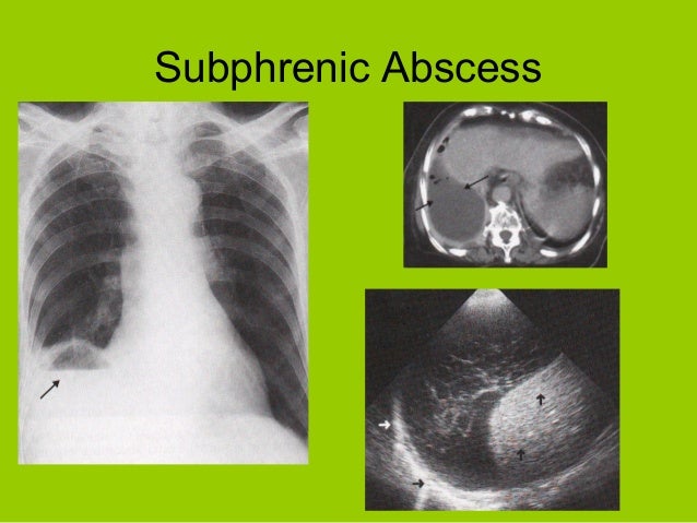 analysis of abdominal x-ray gas.