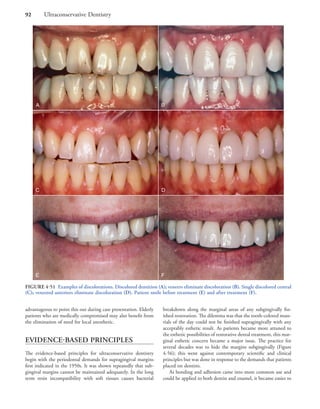 Ultraconservative Dentistry | PDF