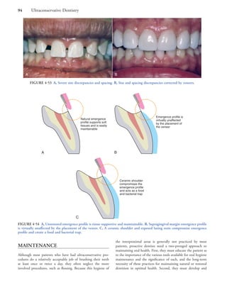 Ultraconservative Dentistry | PDF