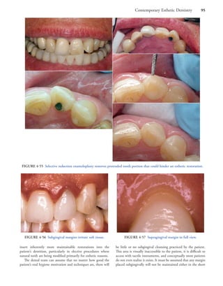 Ultraconservative Dentistry | PDF