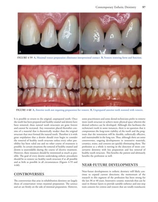 Ultraconservative Dentistry | PDF