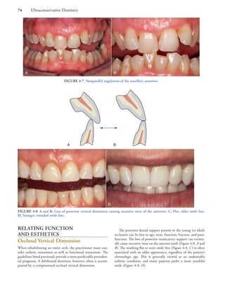 Ultraconservative Dentistry | PDF