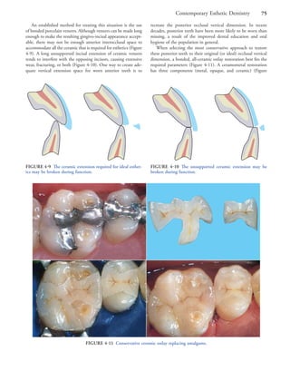 Ultraconservative Dentistry | PDF