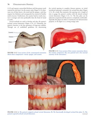Ultraconservative Dentistry | PDF