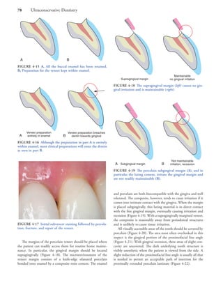 Ultraconservative Dentistry | PDF