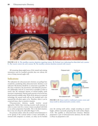 Ultraconservative Dentistry | PDF