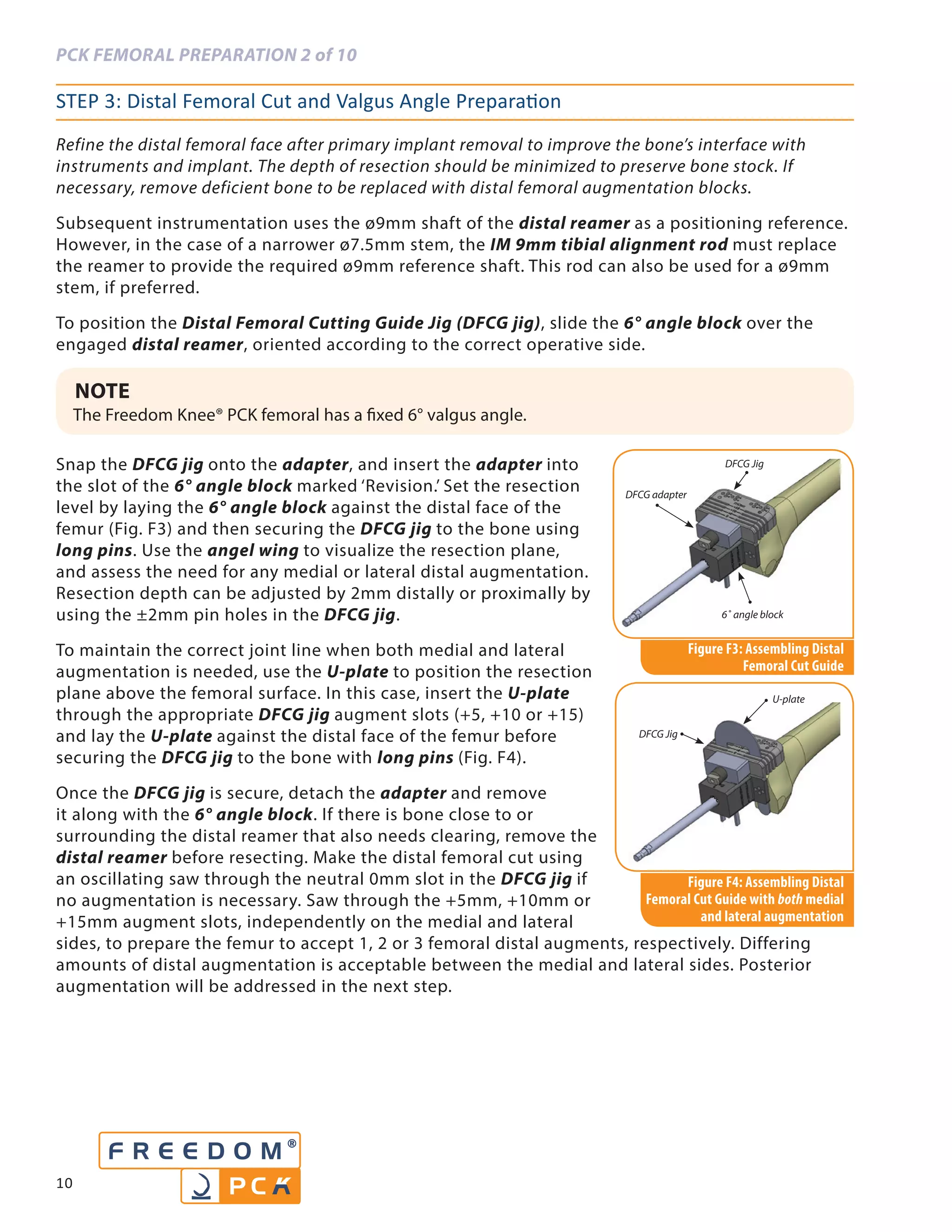 Freedom pck revision knee system by meril life | PDF