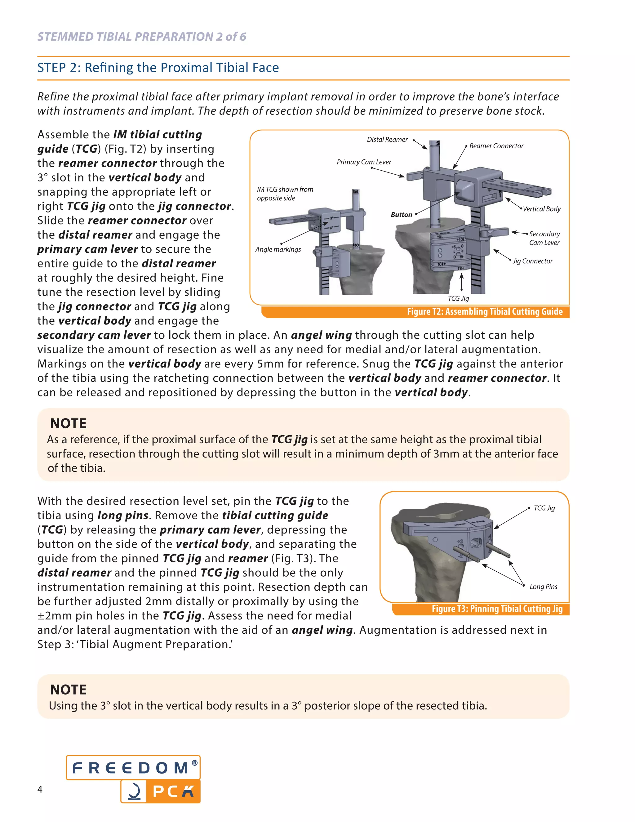 Freedom pck revision knee system by meril life | PDF