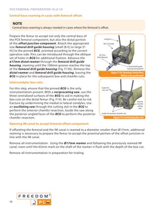 Freedom pck revision knee system by meril life | PDF