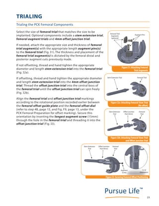Freedom pck revision knee system by meril life | PDF