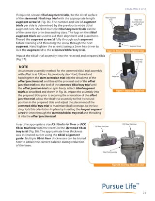 Freedom pck revision knee system by meril life | PDF