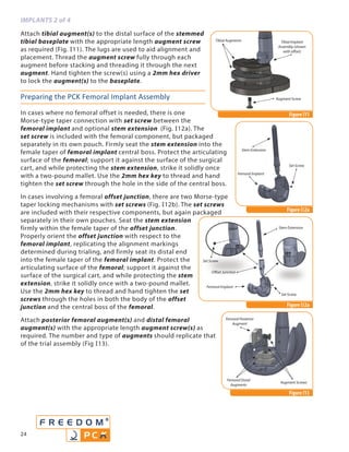 Freedom pck revision knee system by meril life | PDF