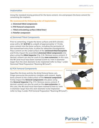 Freedom pck revision knee system by meril life | PDF