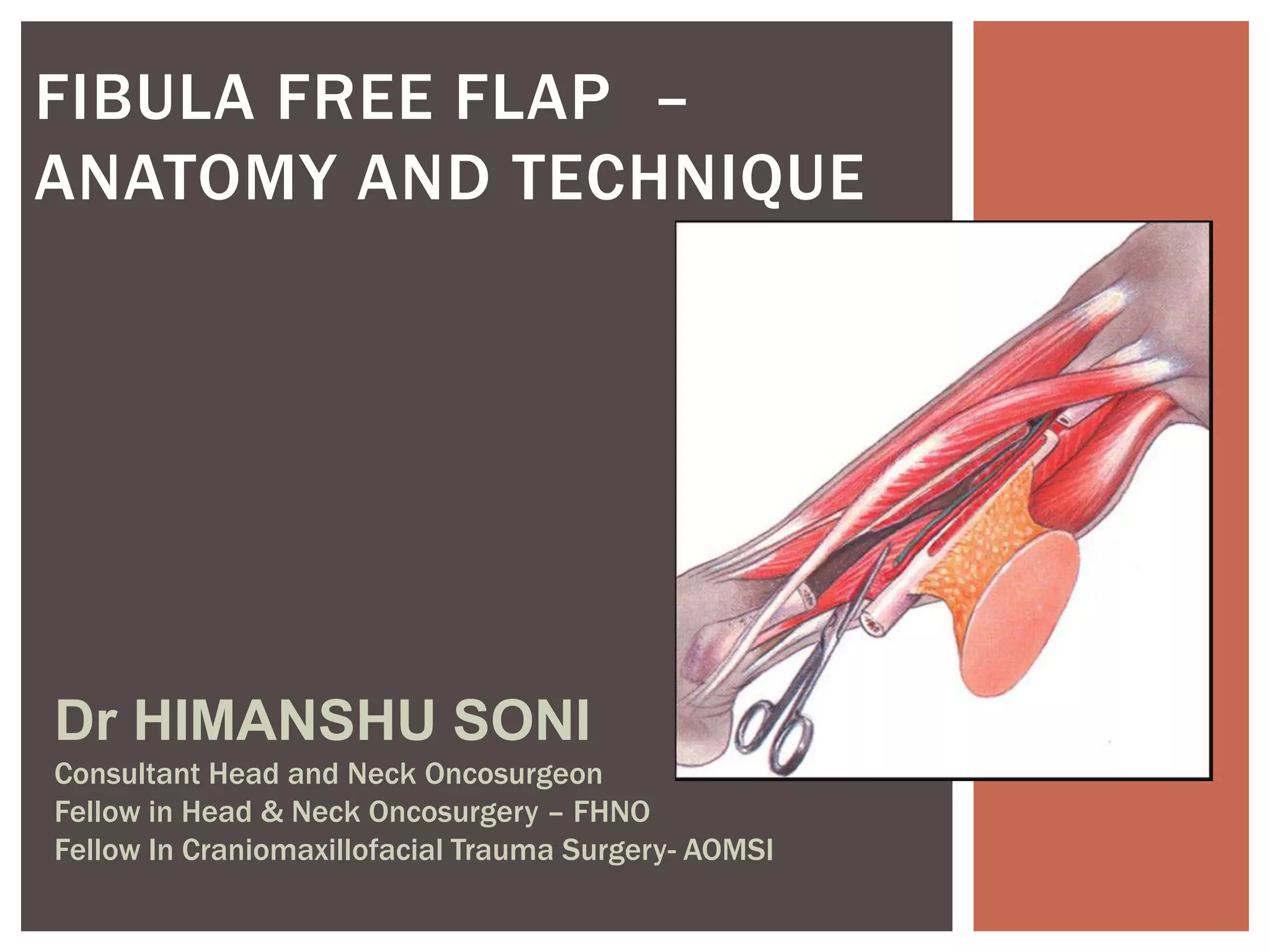 Free Fibula Osteocutaneous Flap | PPTX