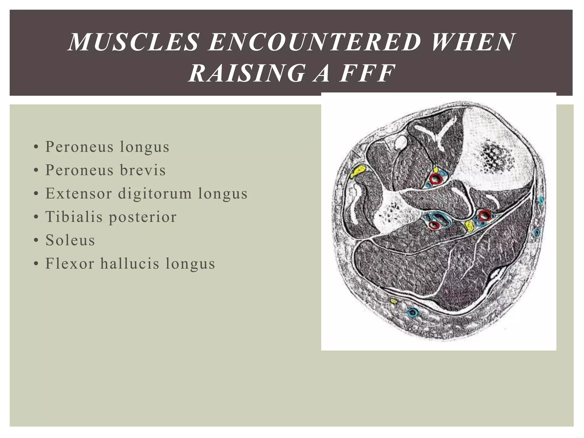 Free Fibula Osteocutaneous Flap | PPTX