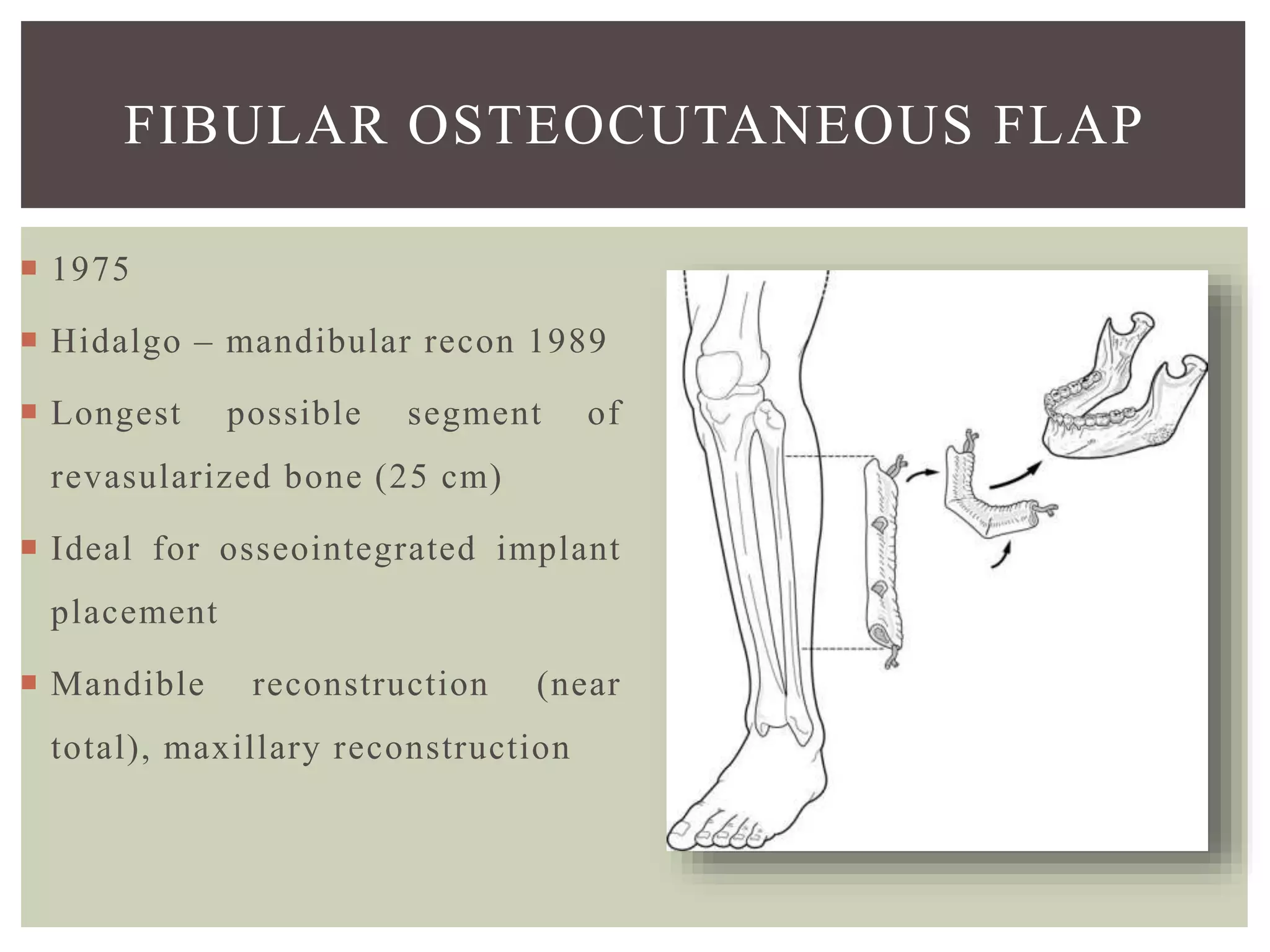 Free Fibula Osteocutaneous Flap | PPTX