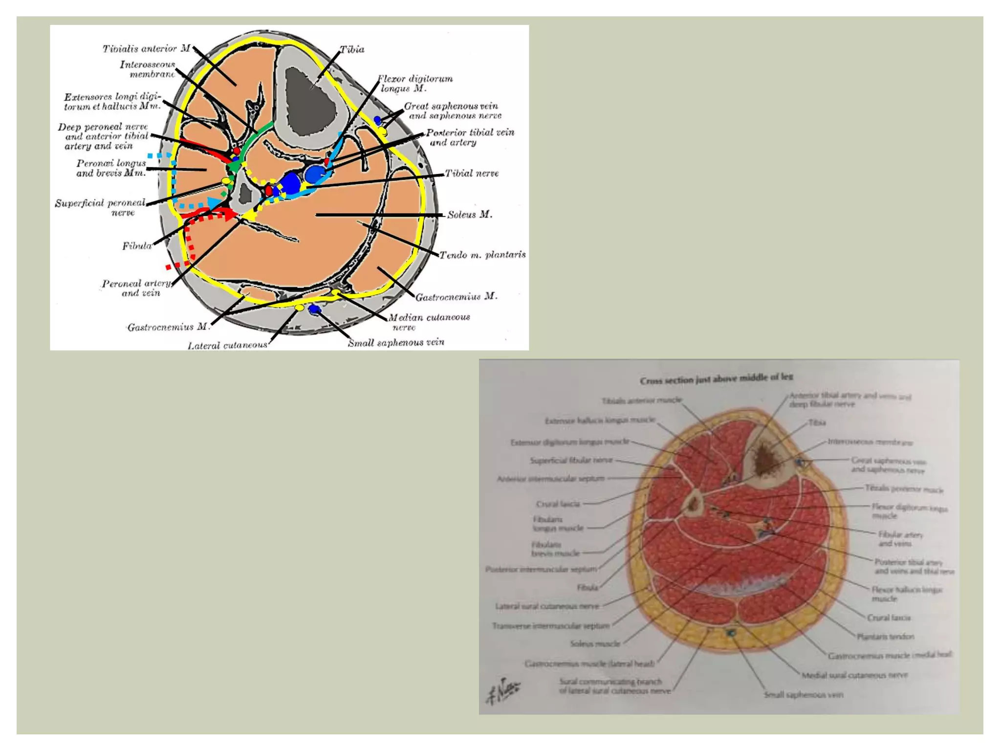Free Fibula Osteocutaneous Flap | PPTX