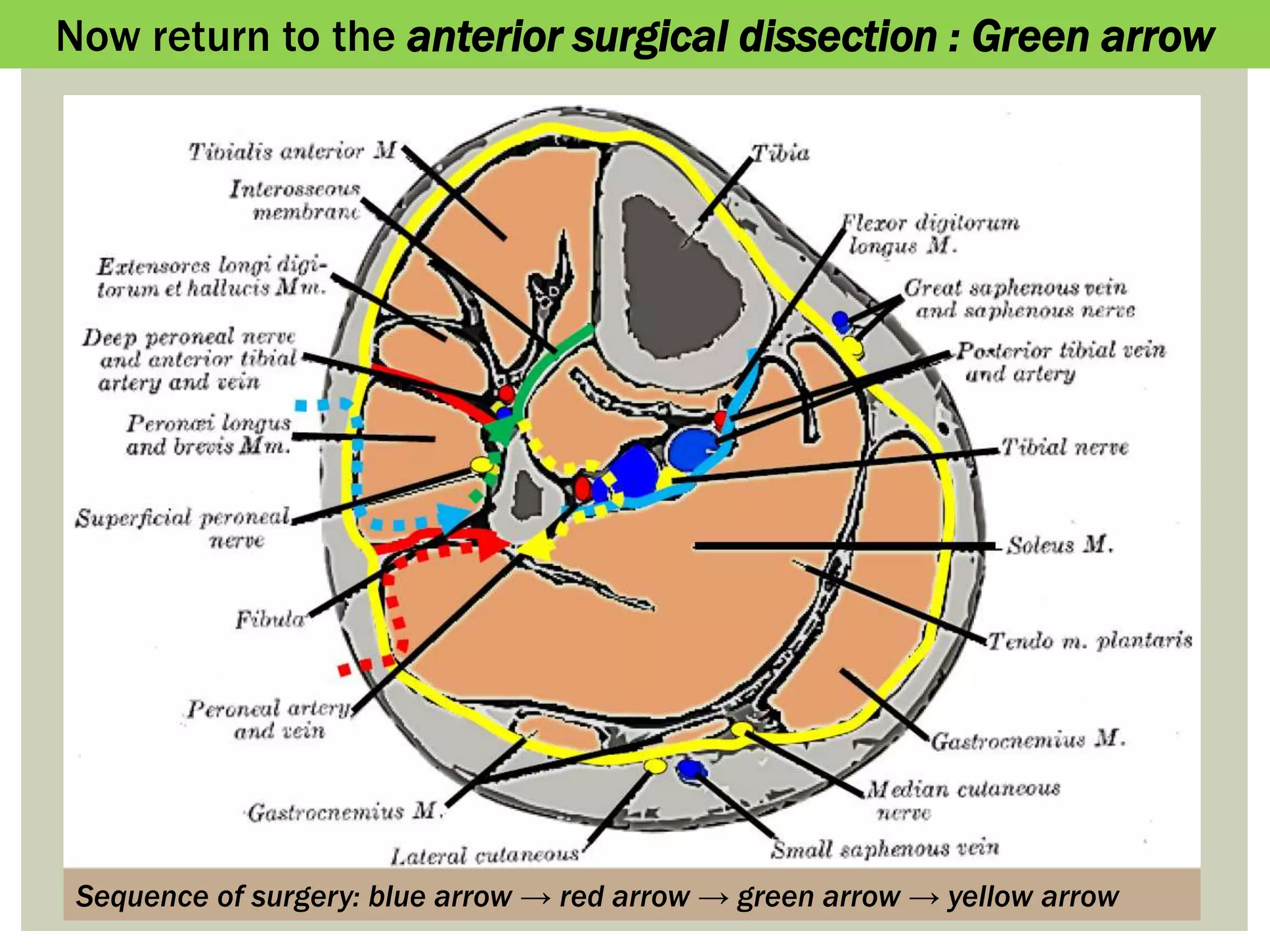Free Fibula Osteocutaneous Flap | PPTX
