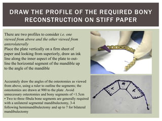 Free Fibula Osteocutaneous Flap | PPTX