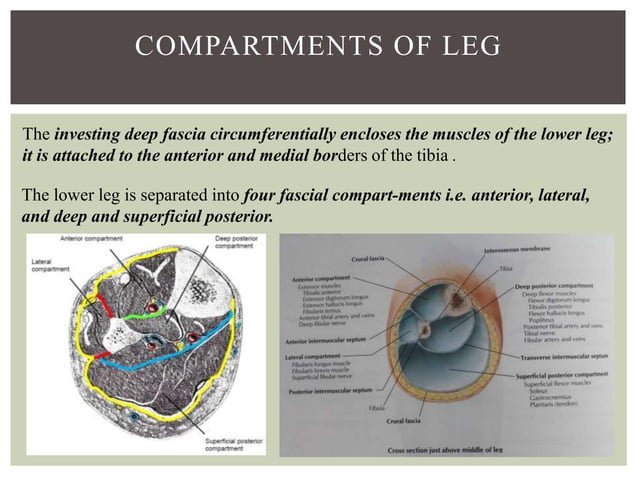 Free Fibula Osteocutaneous Flap | PPTX
