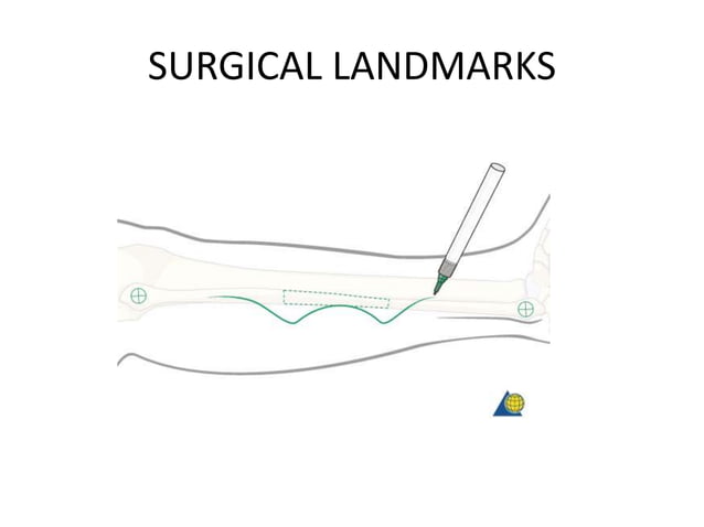 Free fibula flap technique | PPTX