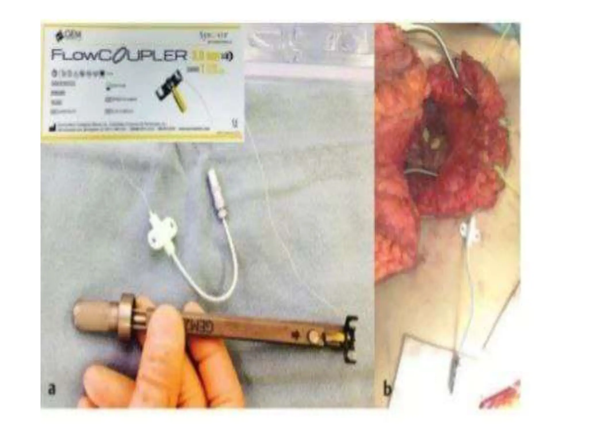 Free Flap Monitoring .pptx