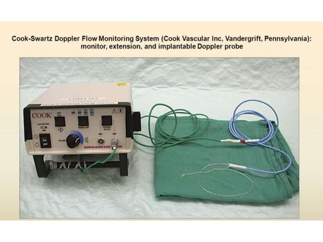 Free Flap Monitoring .pptx