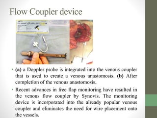 Free flap postoperative evaluation | PPTX