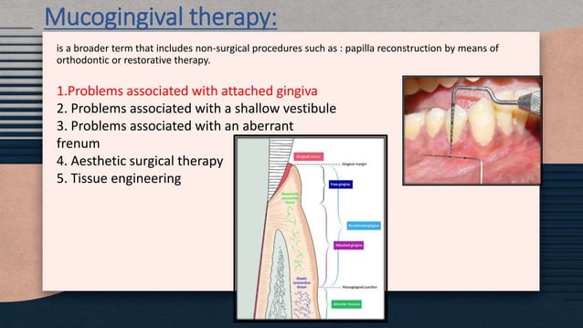 Free gingival graft | PPTX | Dental Health | Diseases and Conditions