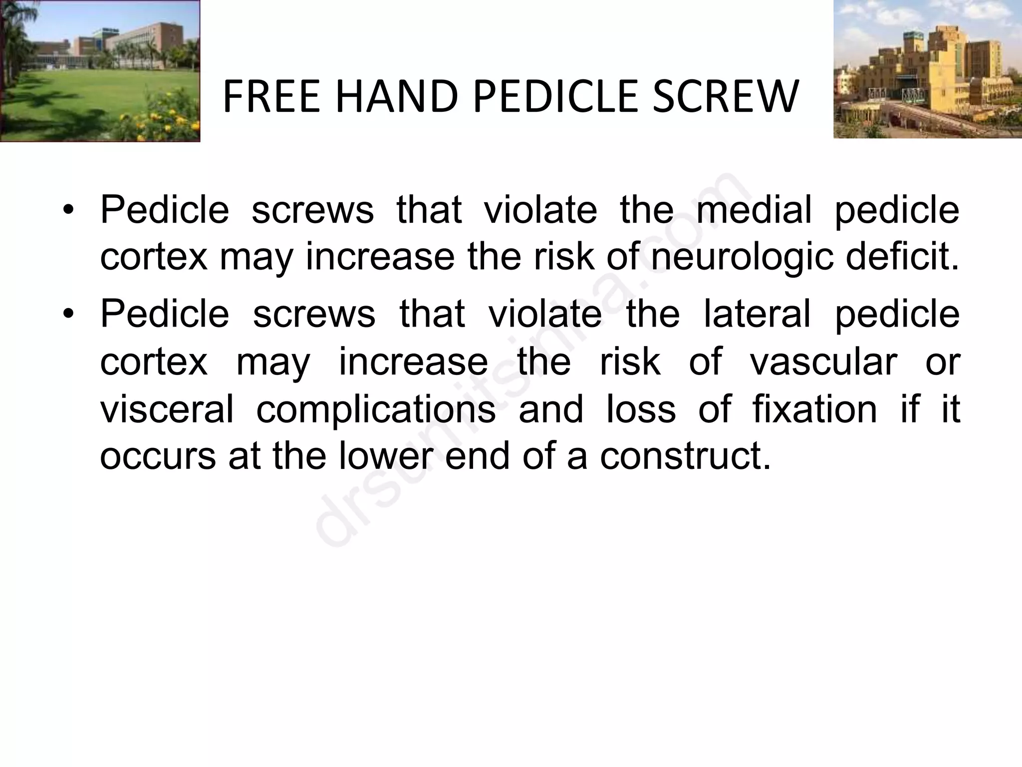 Free hand screw | PPT