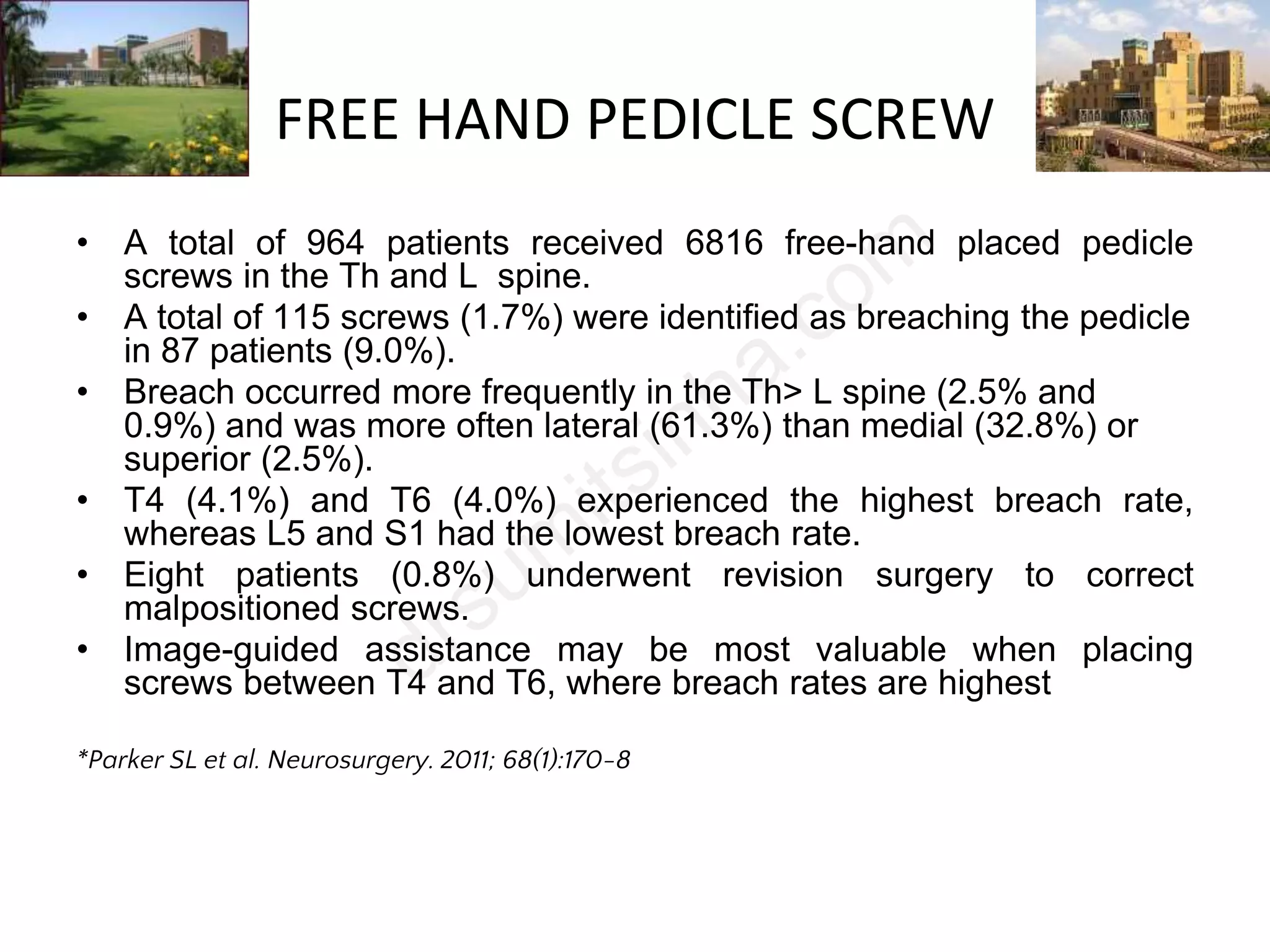 Free hand screw | PPT