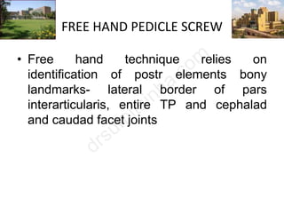 Free hand screw | PPT