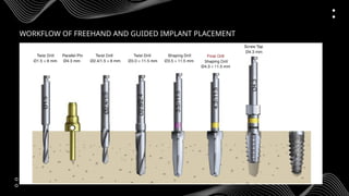 Free hand vs Guided Implant Placement.pptx