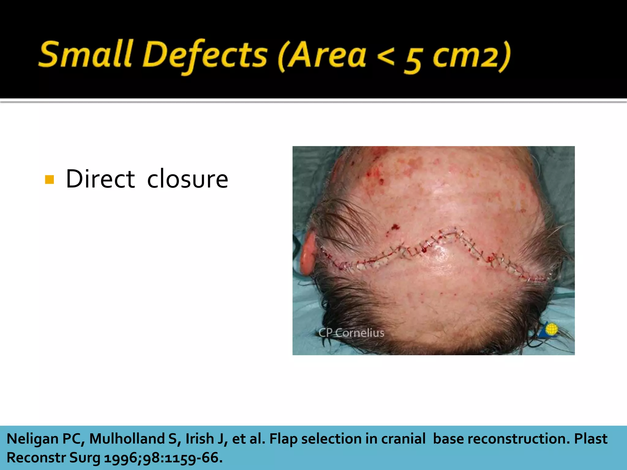Free LD flap for scalp reconstruction DR VIPIN V NAIR | PPTX | Death, Injury, or Military ...